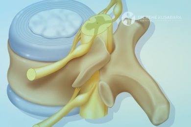 Discos Intervertebrais - Estrutura, Função e Importância